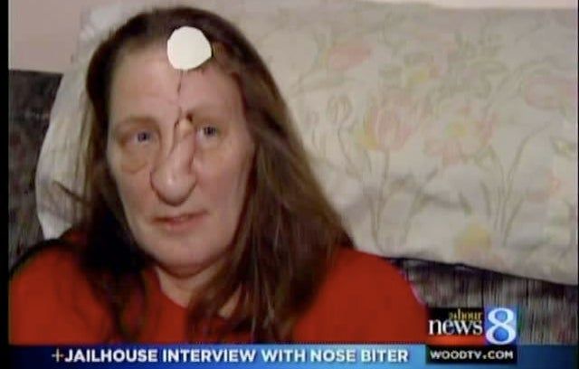 Deadspin | This Week In Unintentional Dong Submissions