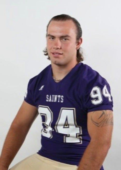 Deadspin | Photos Of College Football Player's Bloomin’ Onion Burns ...