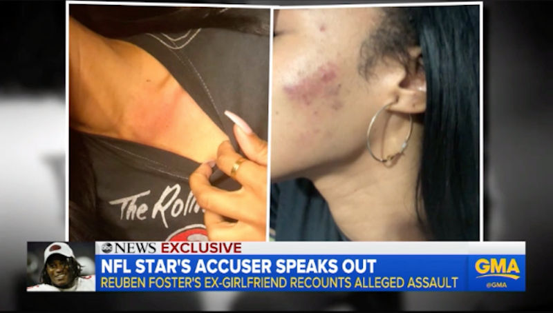 Deadspin | Elissa Ennis Details How She Says Reuben Foster Abused Her ...