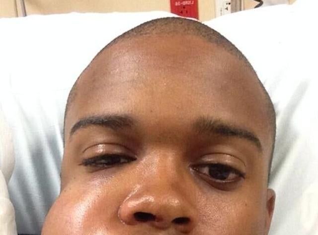 Deadspin | This Is What A 90-MPH Fastball To The Face Looks Like